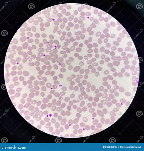 Abnormal Cell Blood Smear Science Concept Stock Image Cartoondealer