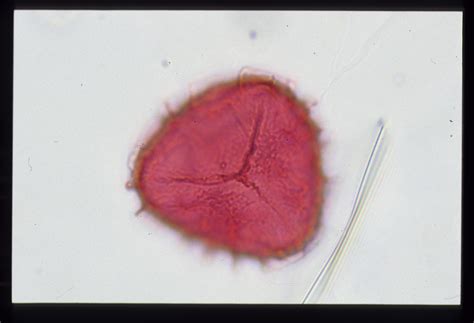 Gpp292 Lycopodium Annotinum Global Pollen Project Global Pollen