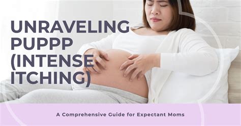 Unraveling Puppp Intense Itching A Comprehensive Guide For Expectant