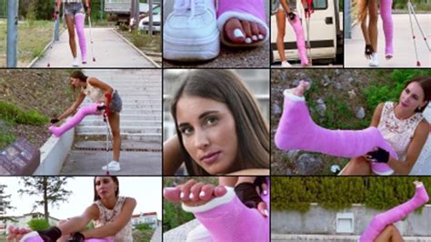 Mirna Llc Crutching In Public In Her Daisy Dukes And Checking Out Her Casted Toes With Foot Play