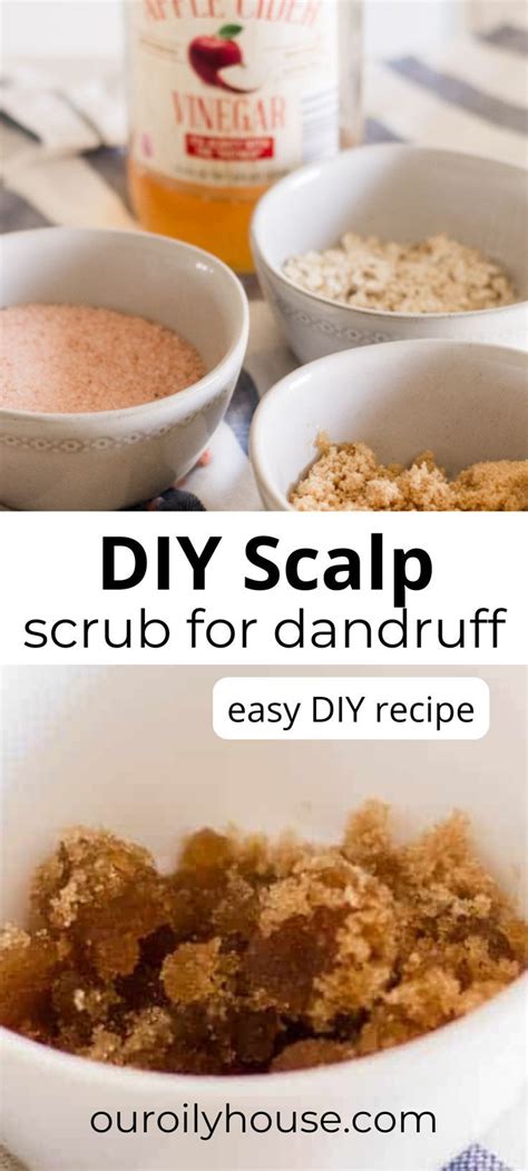 Scalp Diy Artofit