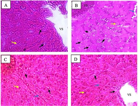Histopathological Of Liver With 40x Magnification Using Hematoxyline