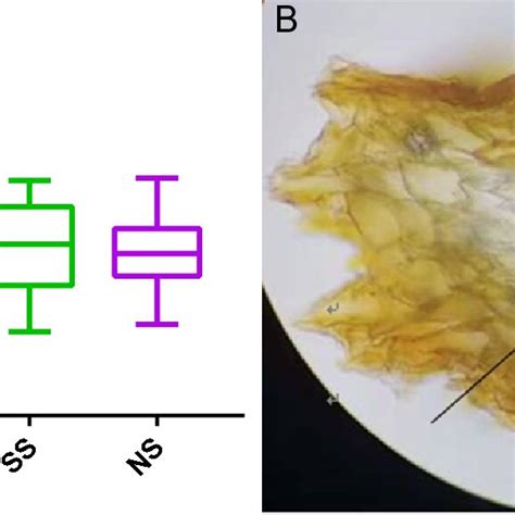 Mycorrhizal Colonization In The P Tabulaeformis A And Mycorrhiza Of Download Scientific