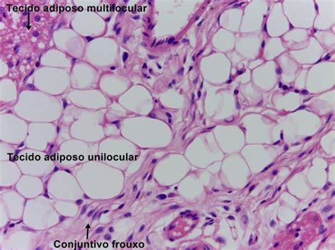 Tecido Adiposo Laminas Histologia E Embriologia