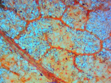 Yolov8 Stomata Object Detection Dataset And Pre Trained Model By Bt2013