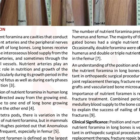 Location Of Nutrient Foramina In Femur And Foramen Index And Comparison