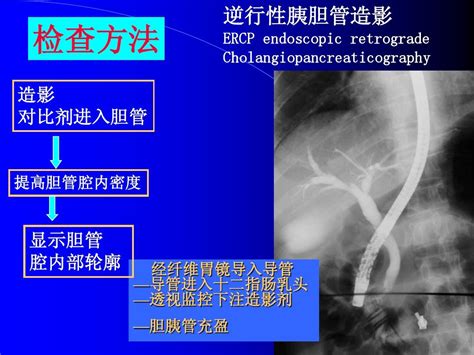 肝 脏 与 胆 系word文档在线阅读与下载无忧文档