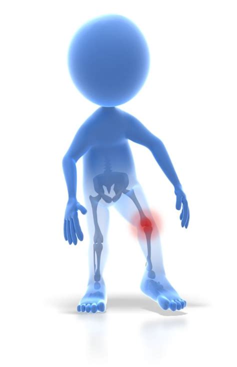 Free Knee Clipart Download Free Knee Clipart Png Images Free Cliparts