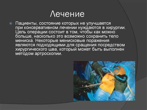 Повреждения и заболевания коленного сустава презентация онлайн