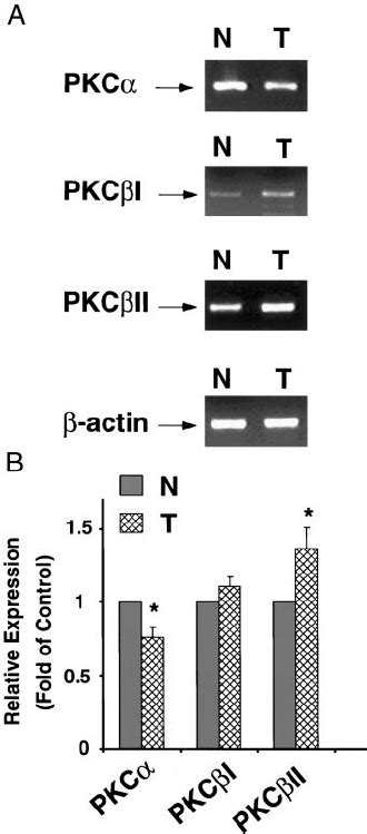 Relative Mrna Levels Of Pkc Isozymes In Aom Induced Mouse Colon Tumors