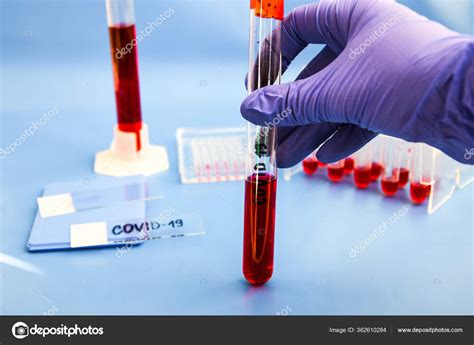 Coronavirus Blood Sample Dna Testing Blood Laboratory Blood Sample