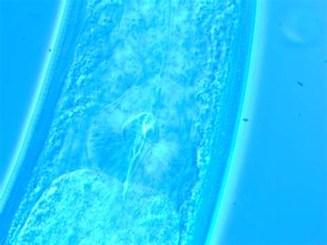 Dorylaimida Applied Nematology Ecology And Acoustical Signatures