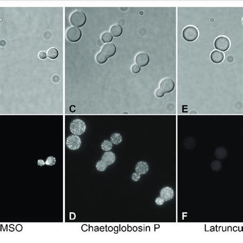 Visualization Of Actin Polymerization And Effects Of Inhibitors In