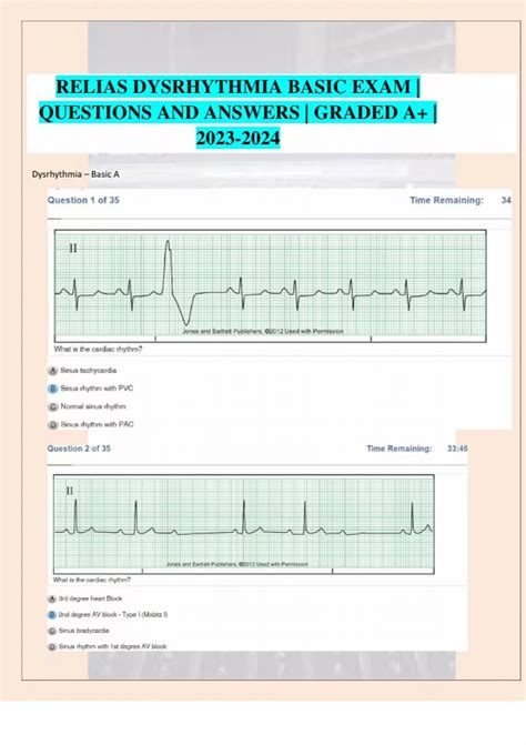 Relias Dysrhythmia Basic Exam Questions And Answers Graded A Dysrhythmia Stuvia Us