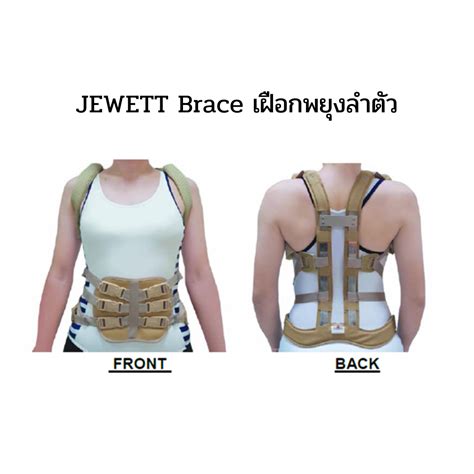 Jewett Brace