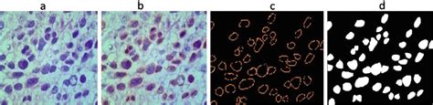 Image Showing The Extraction Of Cells From The Annotated Ground Truth