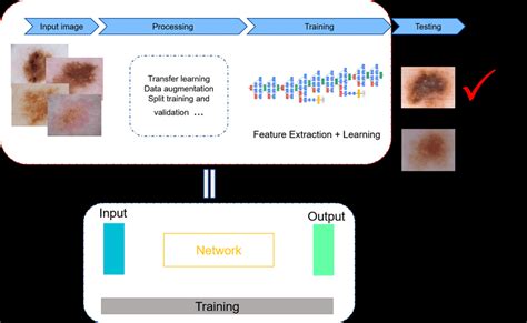 Flow Chart Of Melanoma Diagnosis Based On A General Convolutional