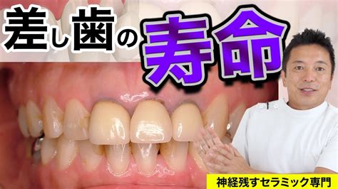 寿命を迎えた差し歯を自然な歯へ Youtube