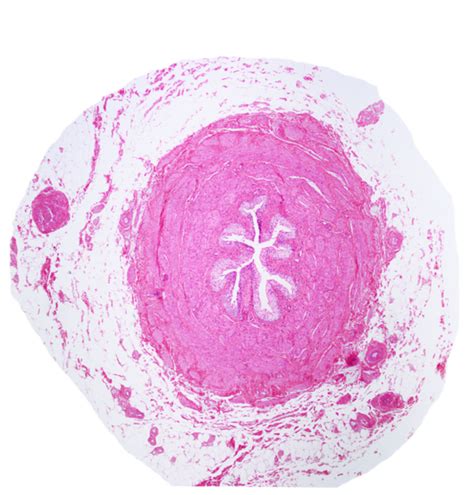 Wagner Ureter Slide Diagram Quizlet