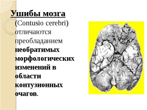 Реферат Черепно мозговая Травма Pleergraphics