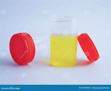 Urinalysis Urine Cup With Reagent Strip Ph Paper Test And Comparison