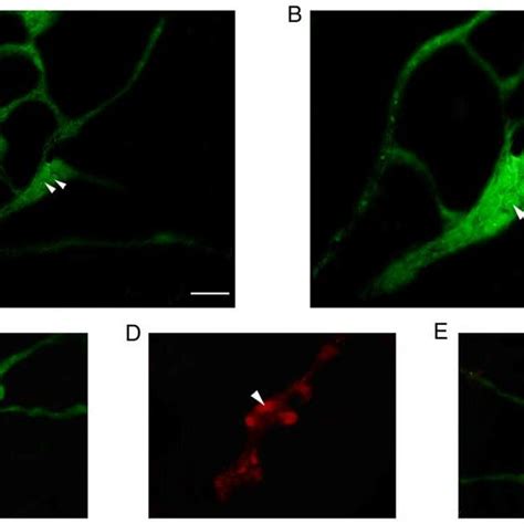 Immunofluorescence Histochemistry Of Submucosal Plexus Of Normal Rat Download Scientific