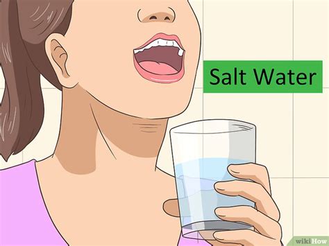 Como Tratar Suas Cáries Imagens wikiHow