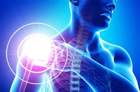 Các điều Cần Biết Về Bệnh án Viêm Quanh Khớp Vai Và Cách điều Trị