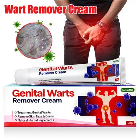 Warts Removal Cream Herpes Genital Warts Condyloma Acuminatum Skin Tags