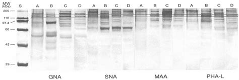 Comparison Of The Lectin Binding Pattern In Different Human Melanoma Research