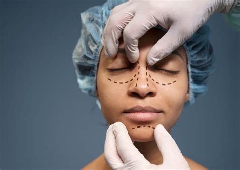 Enhancing Vision And Mobility A Comprehensive Guide To Orbital Floor Fractures Orbital Bone Enhancing Vision And Mobility A Comprehensive Guide To Orbital Floor Fractures Orbital Bone