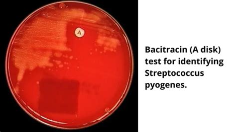 Bacitracin Susceptibility Test Principle Procedure Result Biology