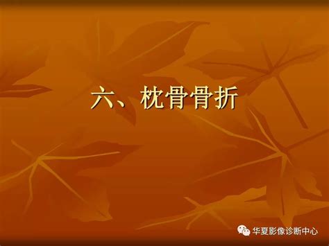 全面的颅骨CT解剖及外伤骨折的诊断建议收藏 MedSci cn