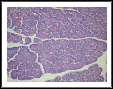 Photomicrograph Of Pancreas Sections Stained With Hematoxylin Eosin A