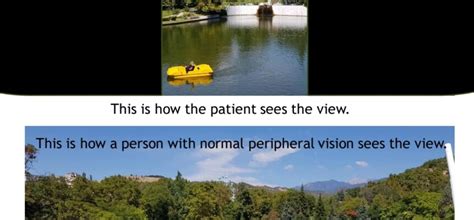 What Is The Visual Defect Shown On The Picture Knowlaxy