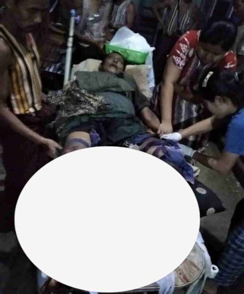 ကျောက်ကြီးမြို့နယ်၊ ကော့ပြင့်ရွာတွင် စစ်တပ်က ထောင်ထားသည့် မိုင်းနင်းမိပြီး ပြည်သူ ၁ ဦးသေဆုံး