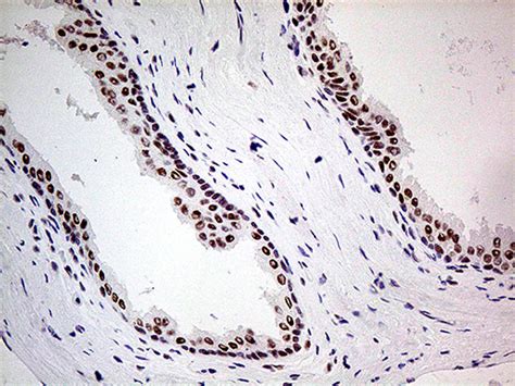 Anti Polr2a Rna Polymerase Ii Antibody Mouse Anti Human Ihcwb Lsbio