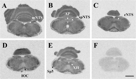 Representative Autoradiograms Of K 33 P Datp Binding In Rat Brainstem Download Scientific