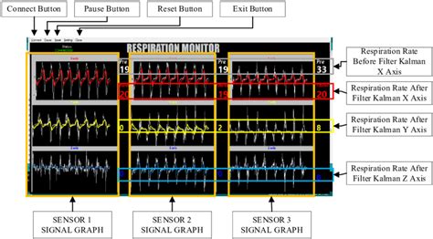 Display On The Delphi App Download Scientific Diagram