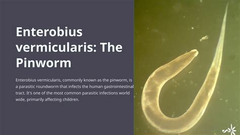 Enterobius Vermicularis The Pinwormpptx
