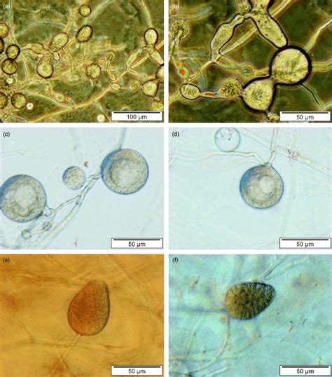 Asexual Structures Of Phytophthora Polonica Formed On Ca A And B