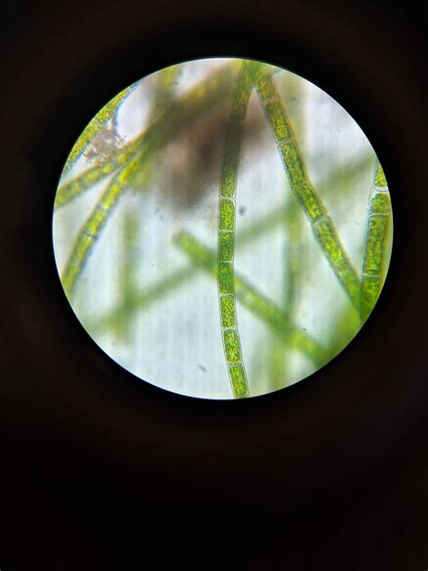 Exploring Algae Through Microscopy Not Only Enhances Our Understanding Of These Organisms But