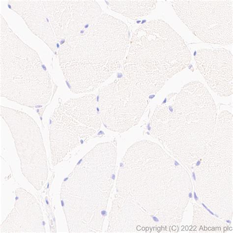Anti Ryanodine Receptor 2ryr 2 Antibody Epr26288 70 Ab302716 Abcam