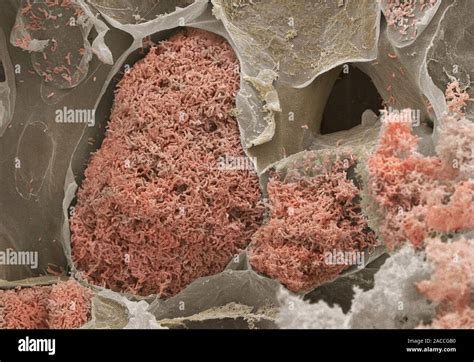 Nitrogen Fixing Bacteria Coloured Scanning Electron Micrograph Sem