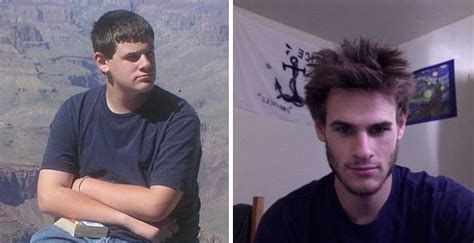 People Share Their Incredible Ugly Duckling” Transformations And Its