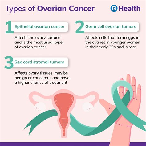 Ovarian Cancer Artofit