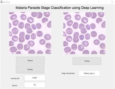 Malaria Parasite Classification Using Deep Learning