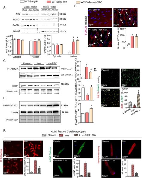 Iron Overload Alters Myocardial Sirt1foxo1 Signaling Which Is Restored