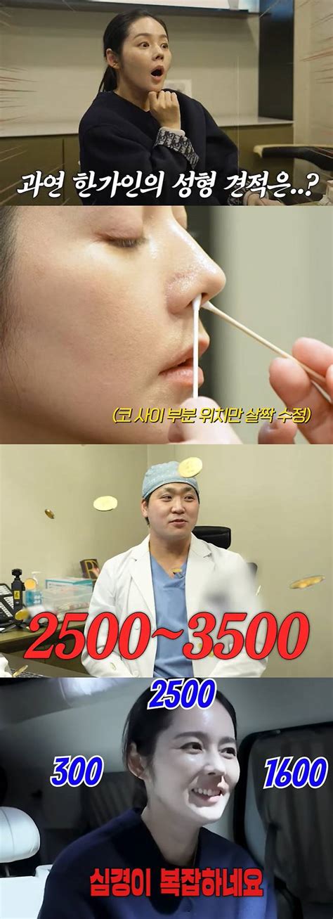 코 비대칭에 눈밑지방 한가인 얼굴 견적 차 한 대 값 충격…미녀 선언하며 성형 포기한 사연