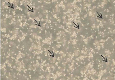 Trypan Blue Test Showing Dead Arrowed And Normal Cells Sirna